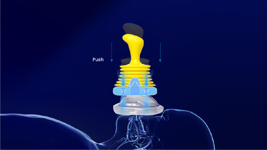 Willnice Store | Explore Top Anti-Choking & Anti-Snoring Solutions