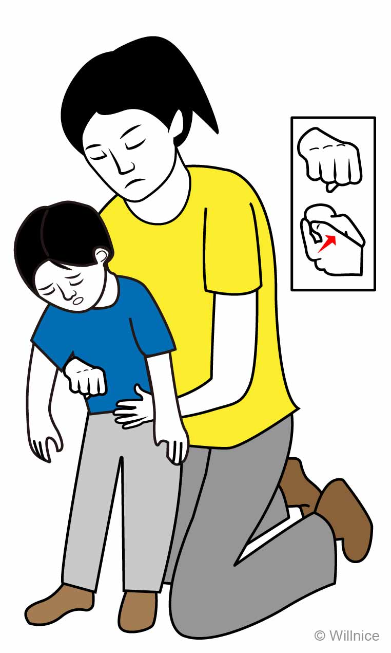 How to Effectively Use First Aid and the Heimlich Maneuver to Stop Choking - Willnice