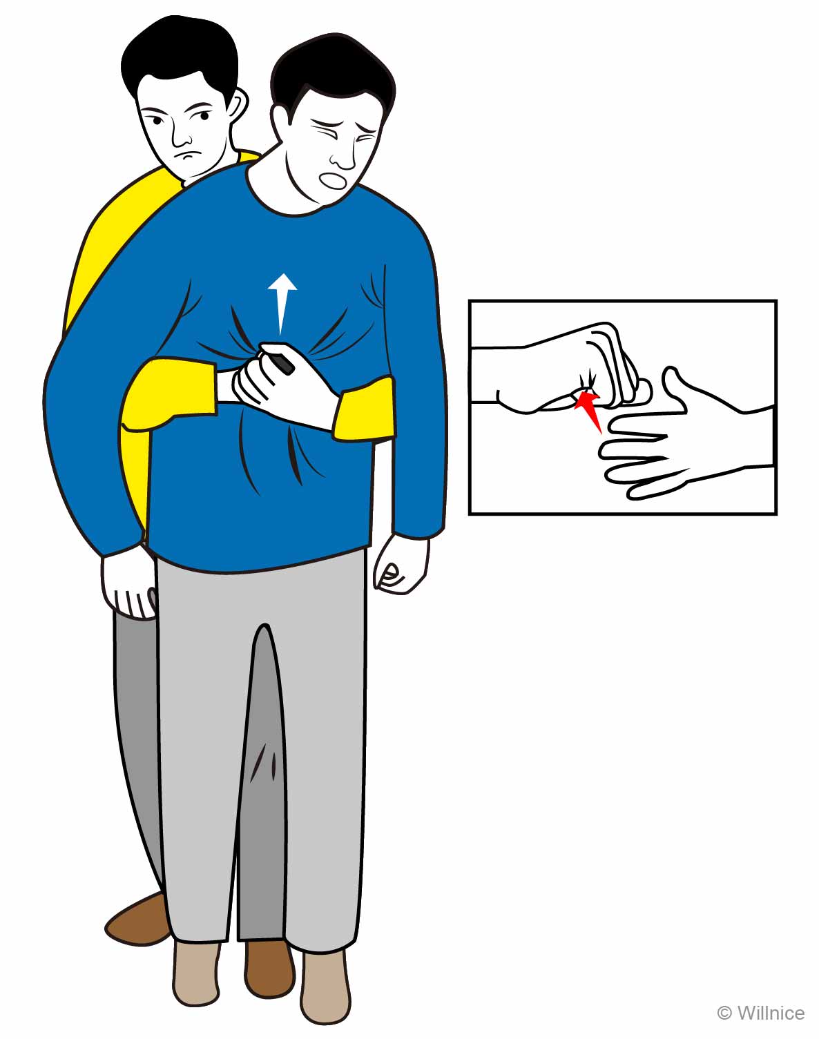 Choking on Food: What to Do When Someone Chokes - Willnice