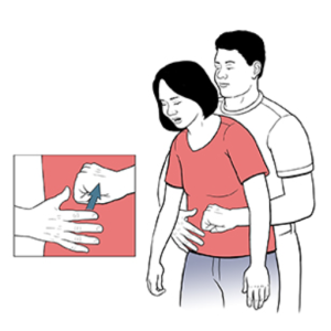 Life-Saving First Aid: What to Do When Someone is Choking - Willnice