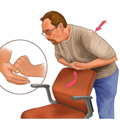 How to Help Someone Who is Choking: Essential First Aid Tips - Willnice