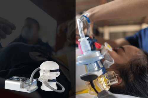 BiPAP vs CPAP: Differences, Benefits, and How a BiPAP Machine Works ...