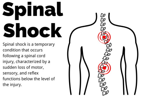 Neurogenic Shock vs. Spinal Shock: Key Differences & Overview - Willnice